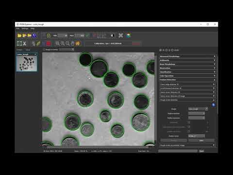 Circular Object Detection - Reactiv IP